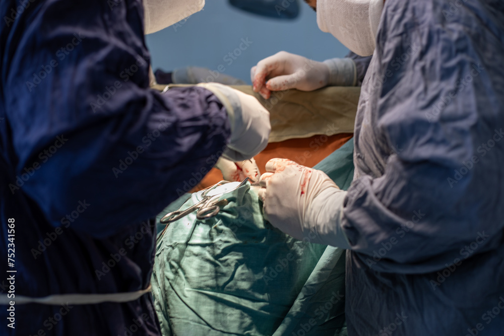 neurosurgeon , doing surgery, operation theater, subdural hematoma in ...