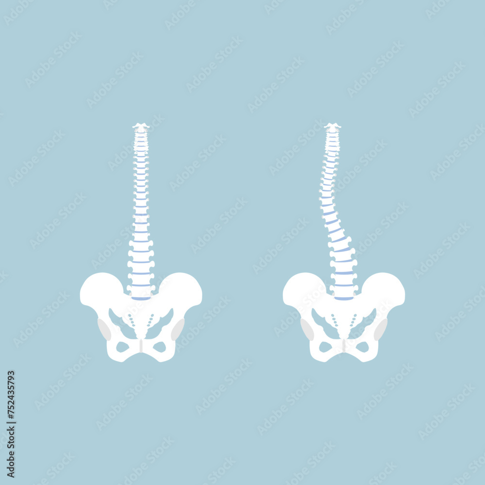 anatomy of human spine, spinal cord, scoliosis, internal organs body ...