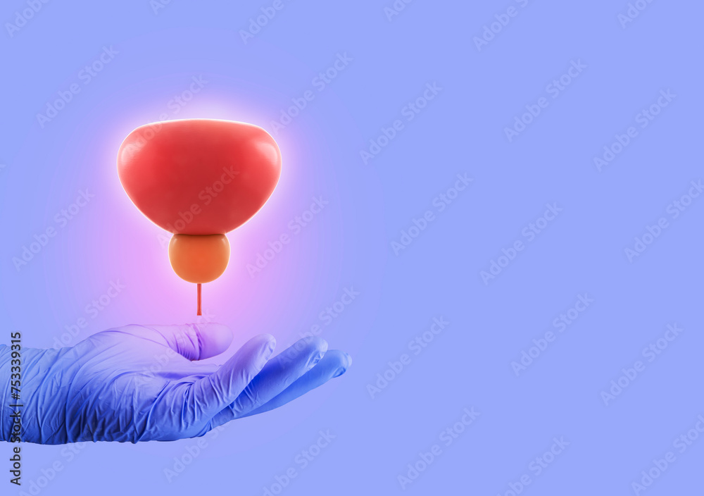 Prostate cancer, bladder cancer. Study and analysis of the prostate ...