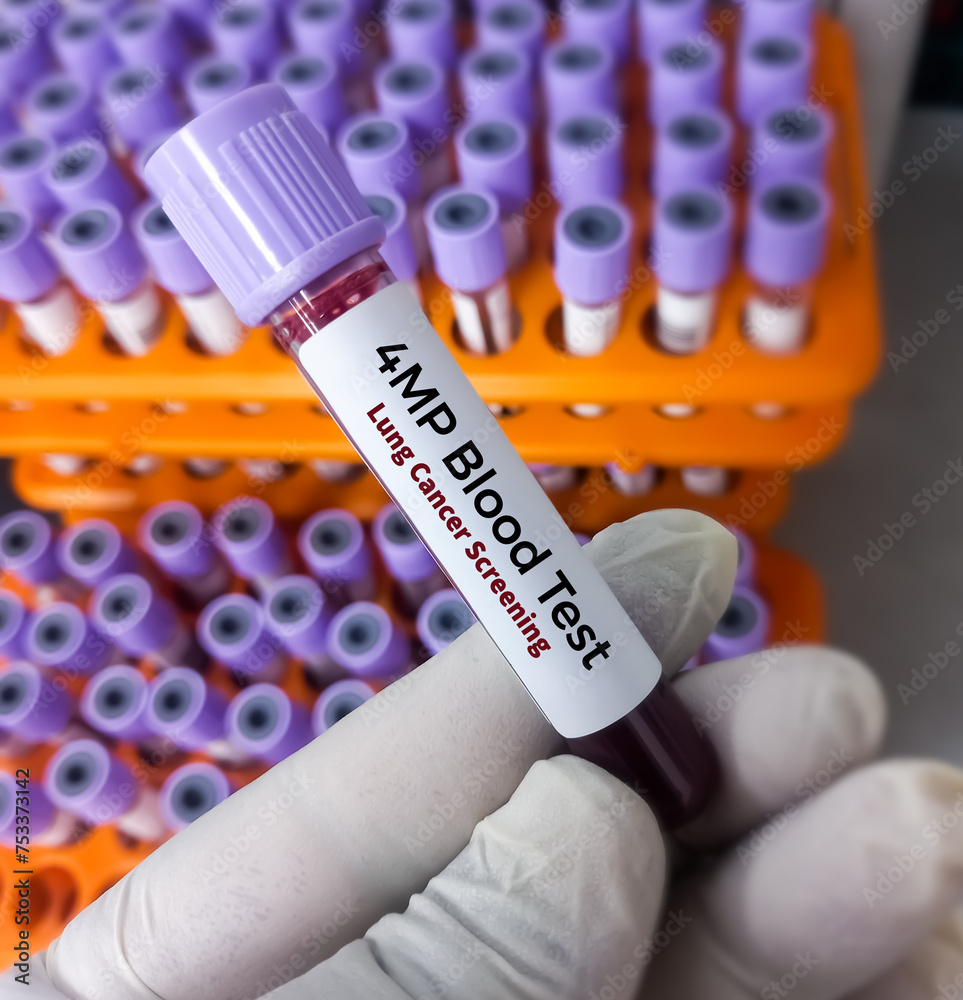 Blood sample for blood-based four-marker protein (4MP) panel, can help ...