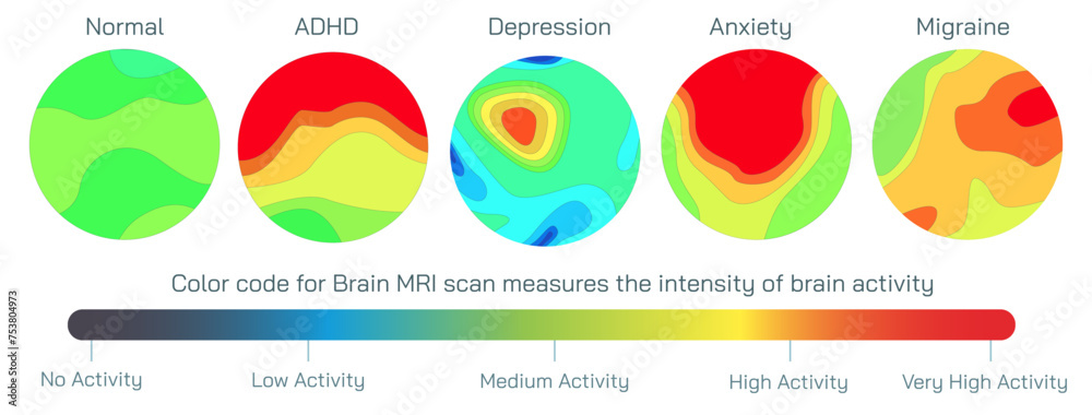Brain MRI scan vector illustration. Magnetic resonance imaging is a ...