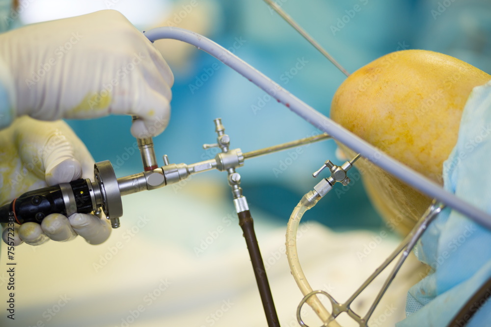 Doctor is doing drainage in knee at the center of endosurgery and ...