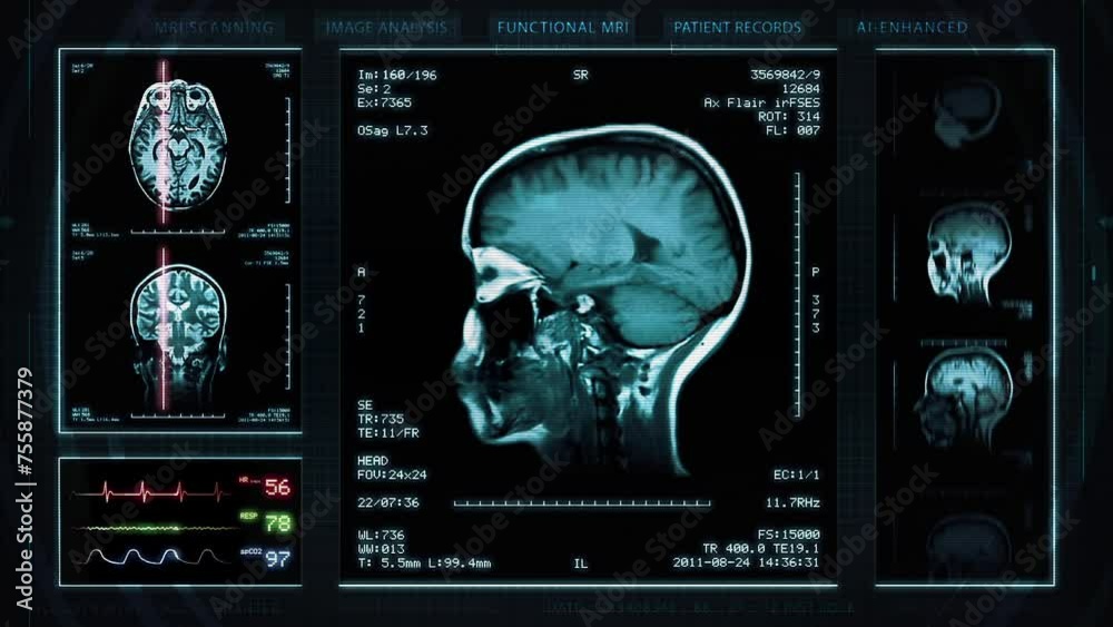 Medical Profile of Patient Showing Head, Neck and Knee MRI Scan. Vital ...