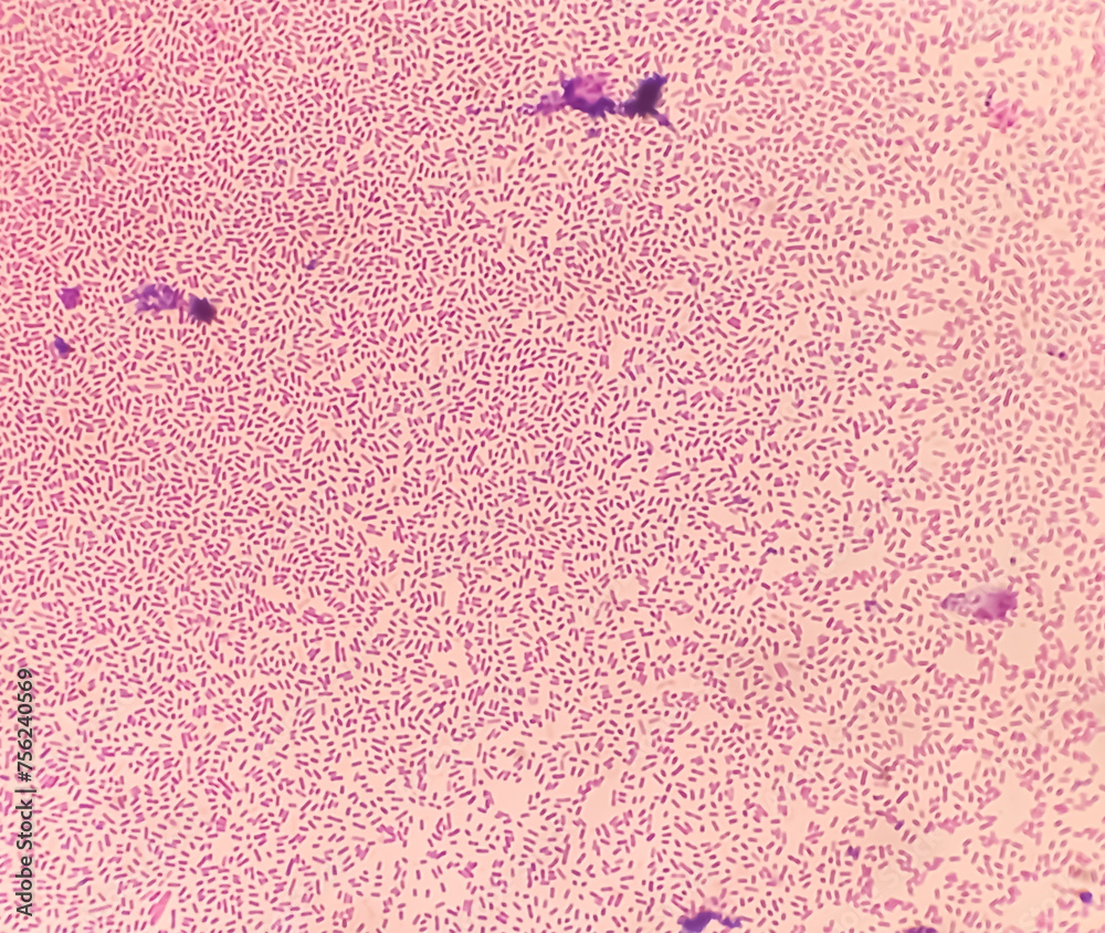 Salmonellosis. Microscopic view of gram stained slide from blood agar ...