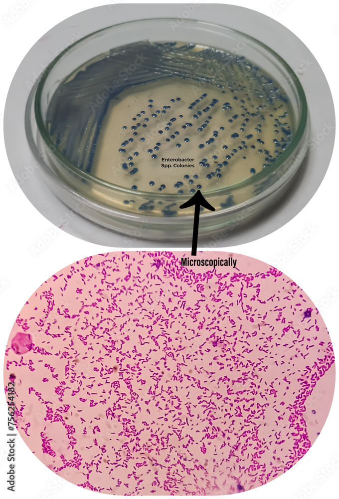 Growing Enterobacter spp bacteria in chromogenic agar medium with ...