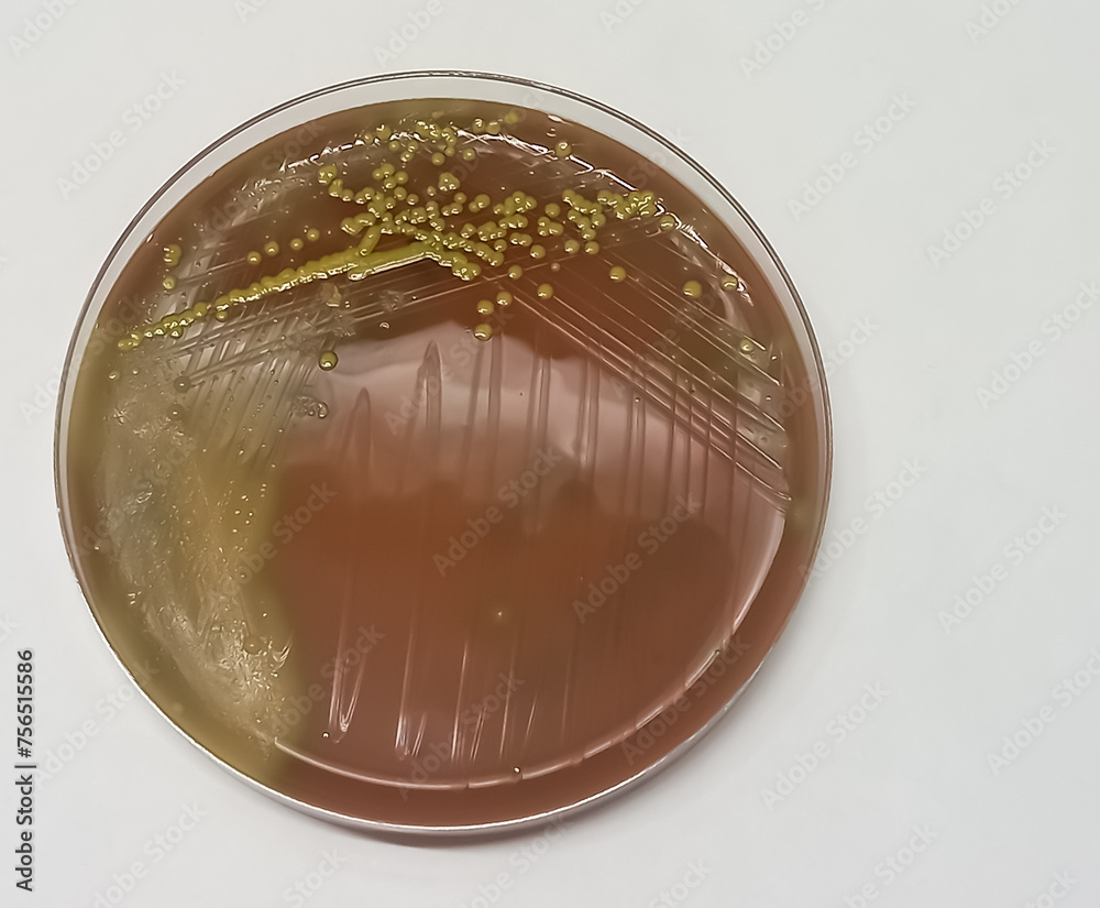 Foto de Golden color colonies on chocolate agar medium, growth of ...