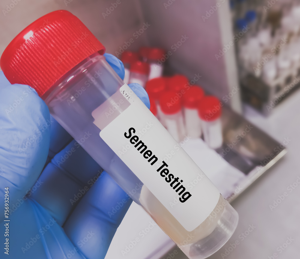 Semen sample for sperm testing. Semen analysis. Sperm count test. Stock ...