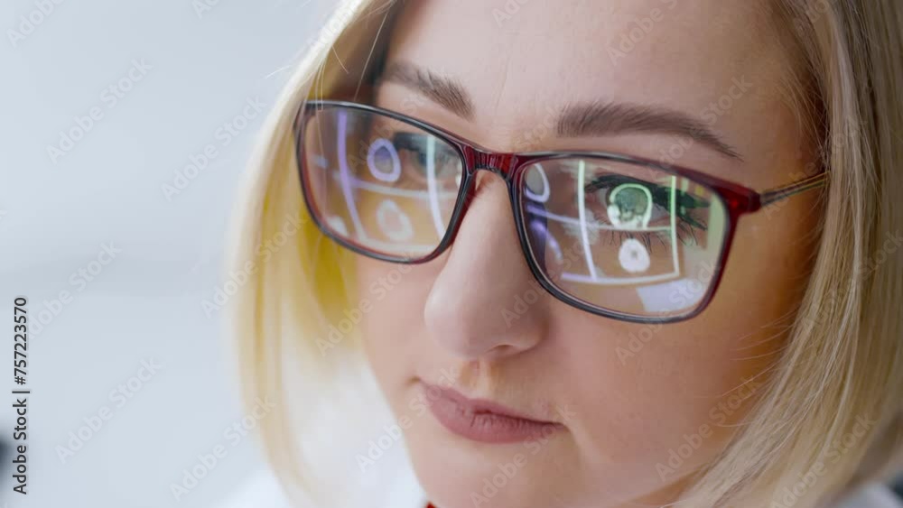 Close-up of glasses and reflection of MRI scan panorama. Close-up of a ...