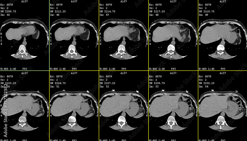 Axial contrast of the cardio system with radiology. A computerized ...