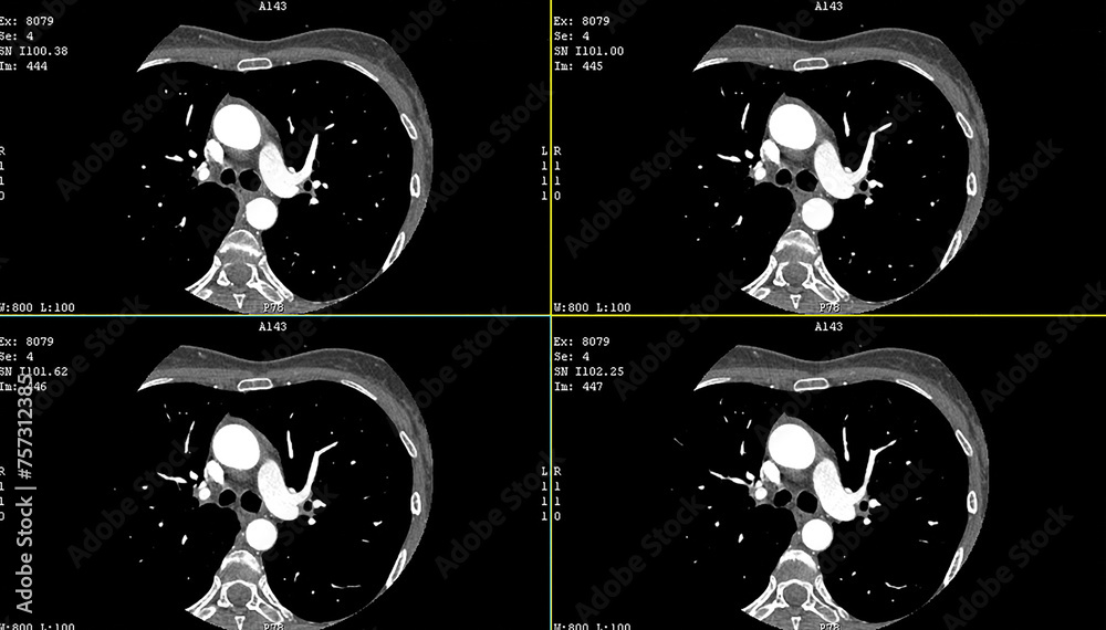 Axial contrast of the cardio system with radiology. A computerized ...
