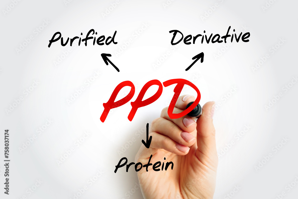 PPD Purified Protein Derivative - test used to detect if you have a ...