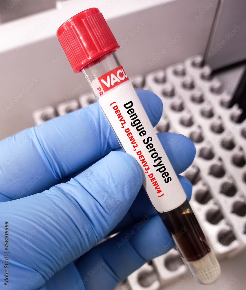 Blood sample for Dengue Serotypes test, DENV1, DENV2, DENV3, DENV4 ...