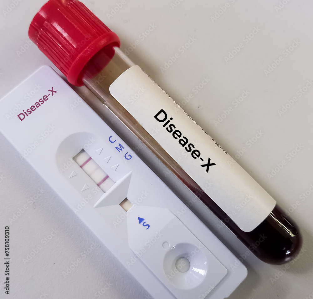 Blood sample and rapid test device for Disease X test. Disease X is the ...