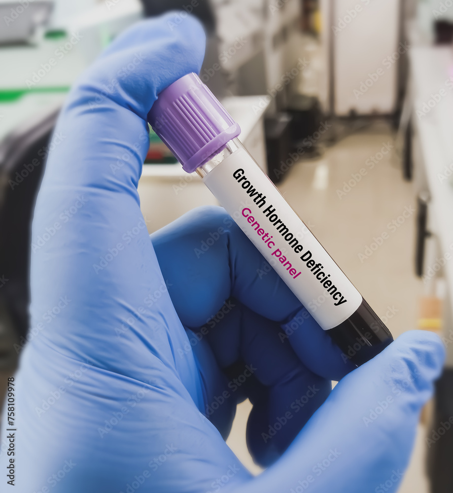 Blood sample for Growth hormone deficiency test to diagnosis Growth ...