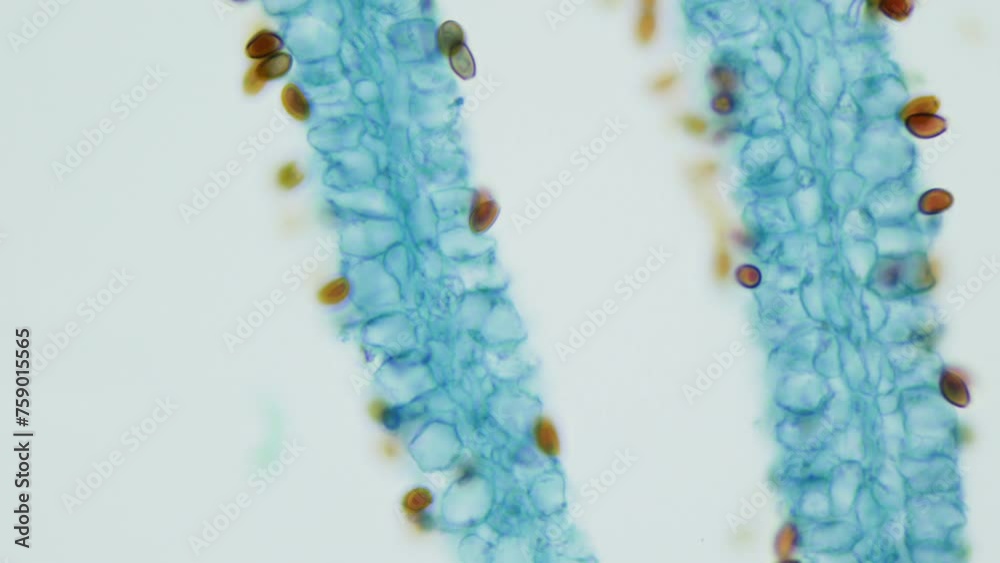 Video Stock Study of adaptability and symbiosis of fungal spores under ...