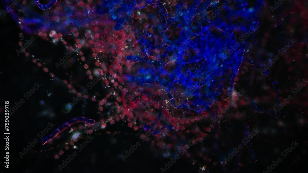Signema algae under microscope. Dark-field microscopy. Study of ...
