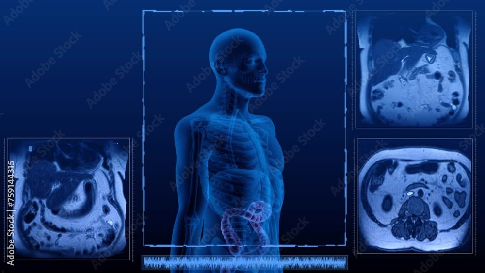 Magnetic resonance tomography scan in different projections of the ...