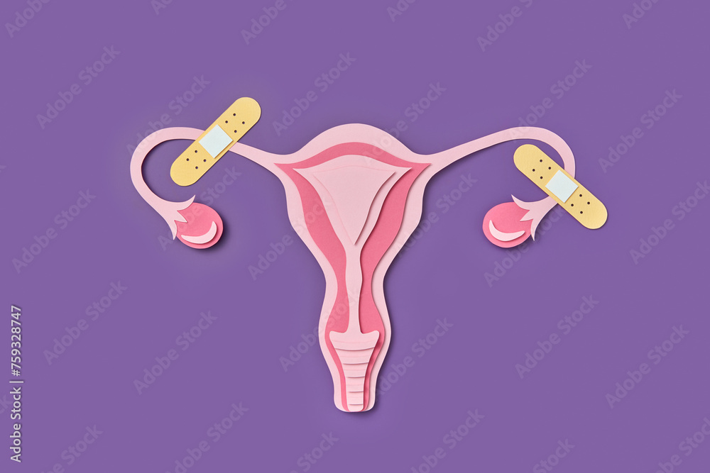Paper made female uterus with adhesive plasters on fallopian tubes ...