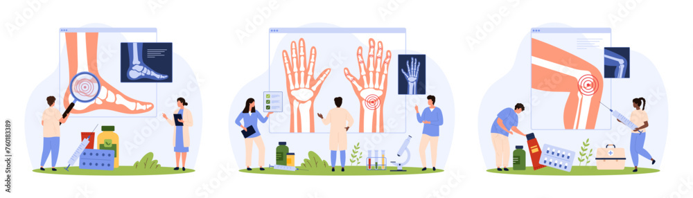 Vetor de Diagnosis and treatment of osteoarthritis, rheumatoid ...