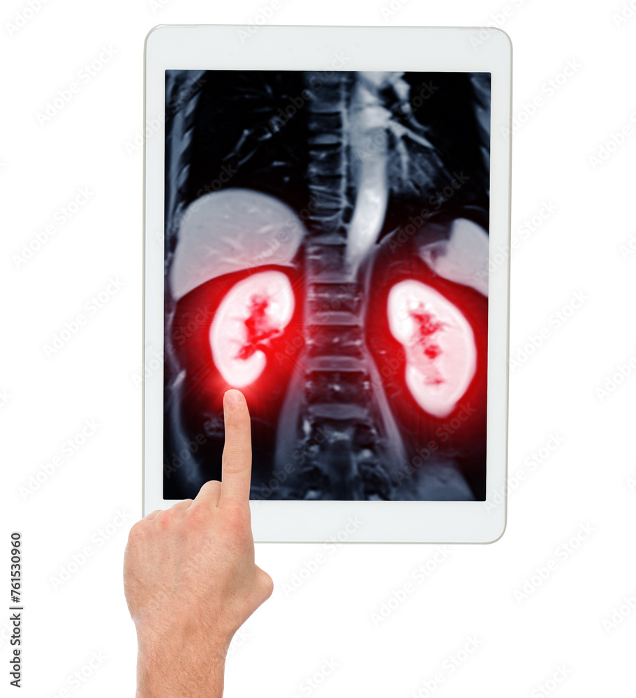 MRI of the upper abdomen coronal view is a non-invasive imaging ...