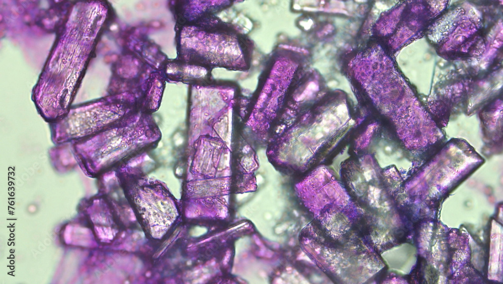 Triple Phosphate Crystals or struvite in cat urine, microscope view ...
