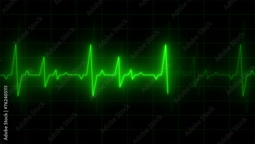 Neon Electrocardiogram Heartbeat Pulse Heart attack monitoring Medical ...