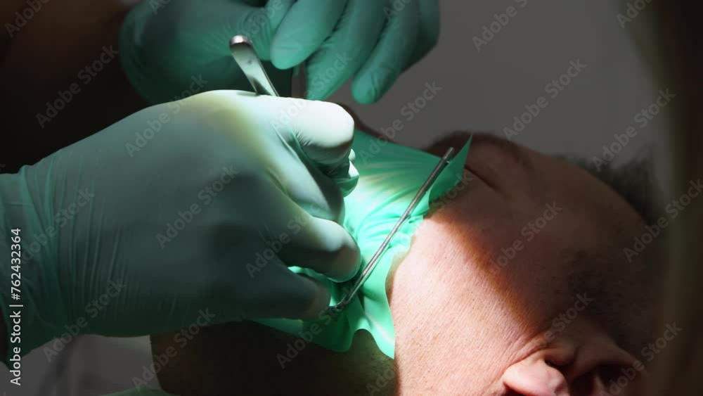 Close-up shot of patient's face with cofferdam. Hands of dentist treat ...