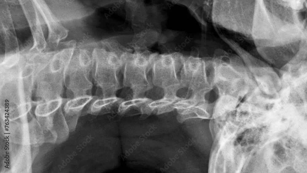 Time lapse of MRI human spine neck scan set, timelapse magnetic ...