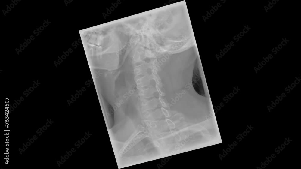 Time lapse of MRI human spine neck scan set, timelapse magnetic ...