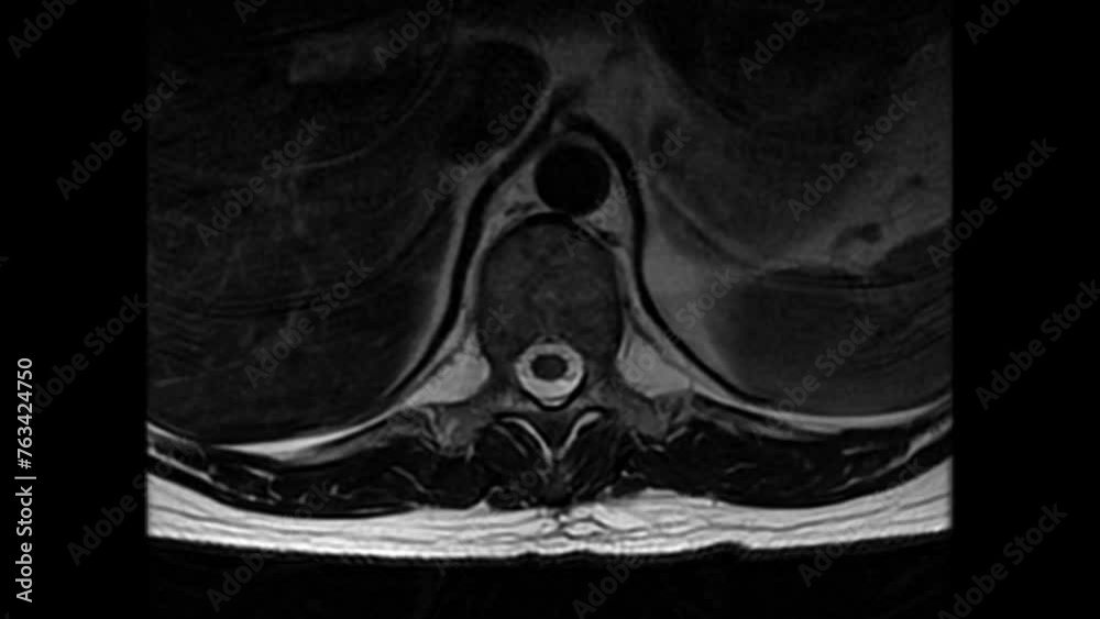 Vidéo Stock Time lapse of MRI human body scan, timelapse of monochrome ...