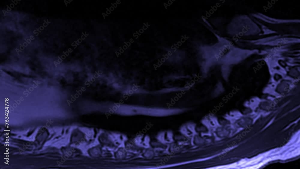 Time lapse of MRI human body scan, timelapse of monochrome magnetic ...