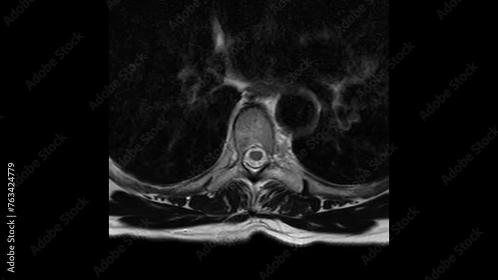 Stop motion of body parts ct or x-ray scan horror collection. Human ...