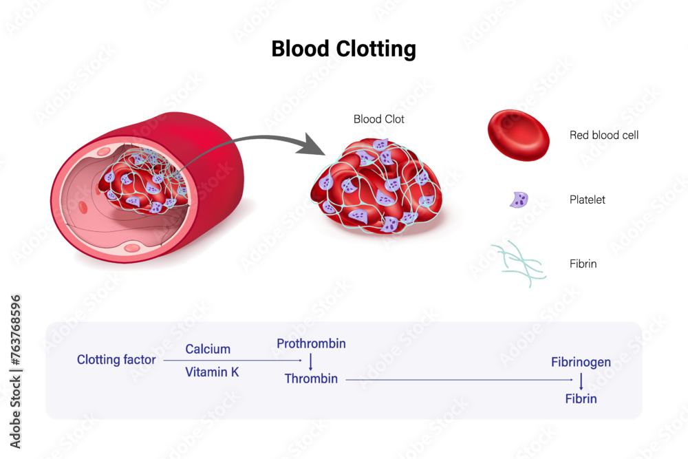 Blood clotting. Clotting chain reaction in blood. Red blood cell ...
