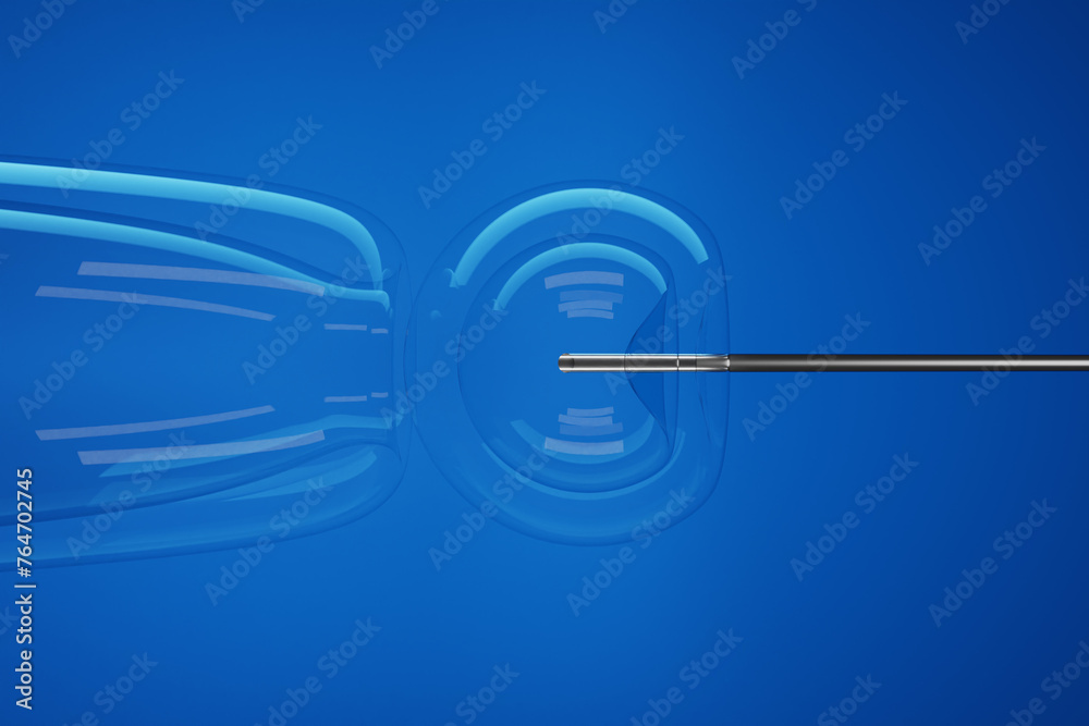 Injection of stem cell into a transparent embryo by a silver sharp ...