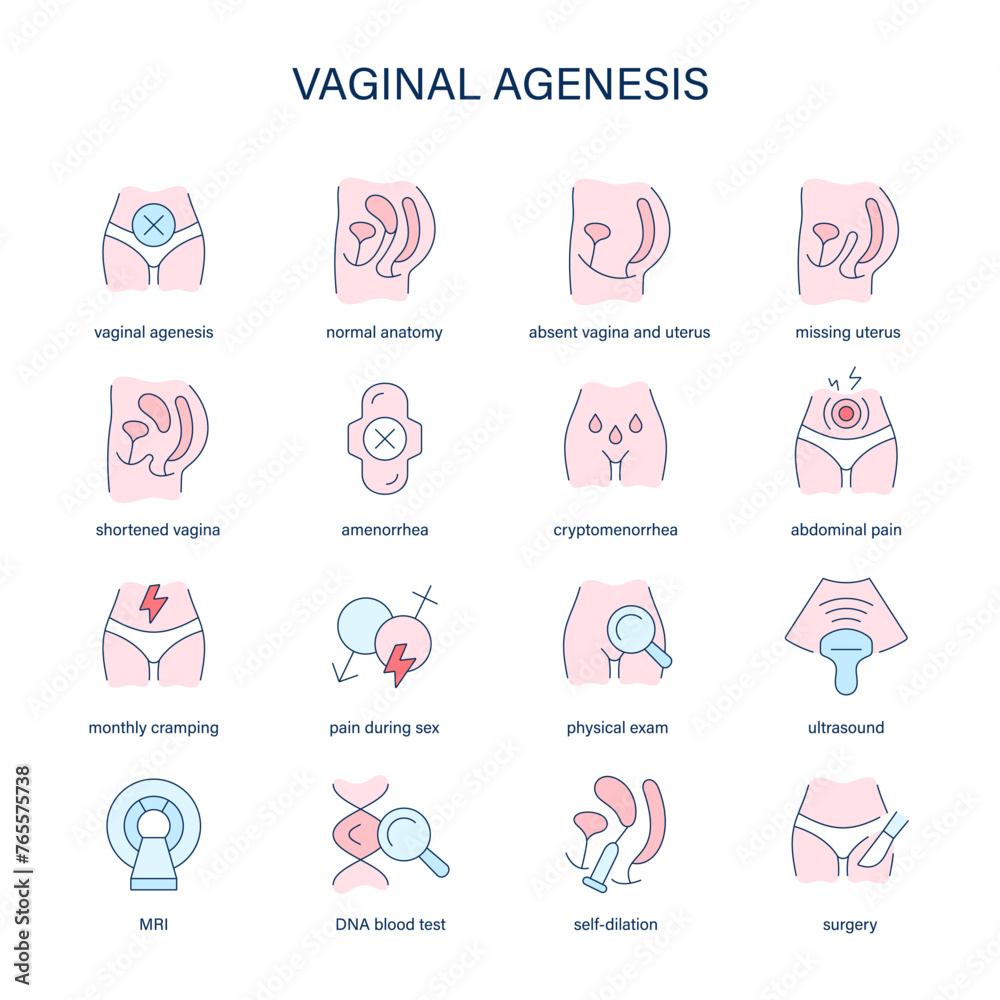 Vaginal Agenesis symptoms, diagnostic and treatment vector icons. Medical icons. Stock Vector ...