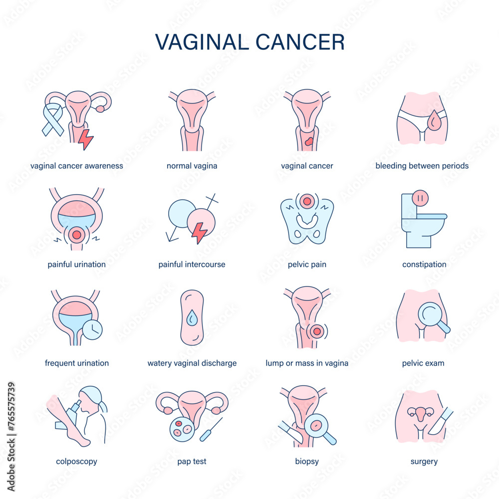 Poster Vaginal Cancer symptoms, diagnostic and treatment vector icons ...
