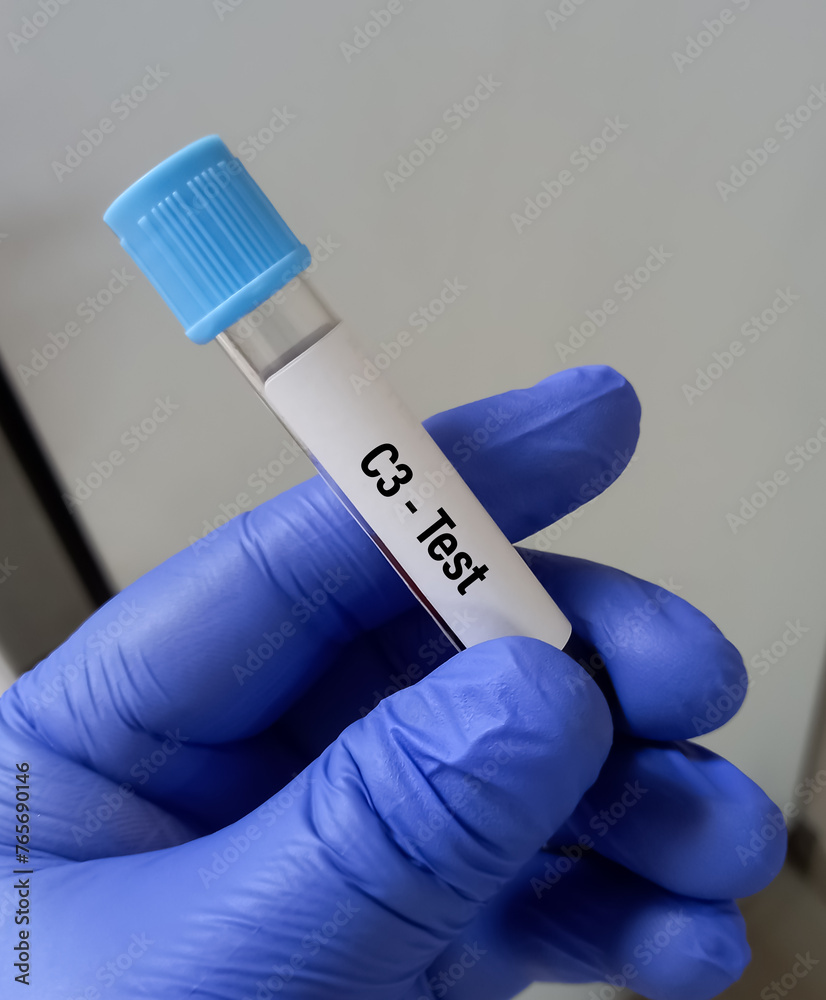 Blood Sample for C3, C4 (Complement) test with laboratory background ...
