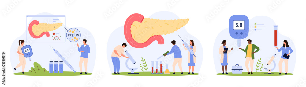 Pancreas checkup, diabetes set. Tiny people check endocrine gland ...