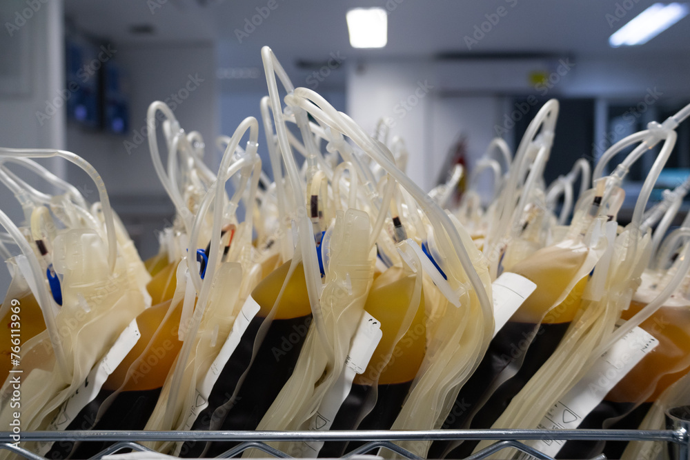 Bags of whole blood donated to obtain plasma, erythrocytes, platelets ...