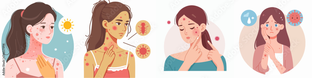 Set Vector people suffer from skin diseases Cartoon Illustration Stock ...