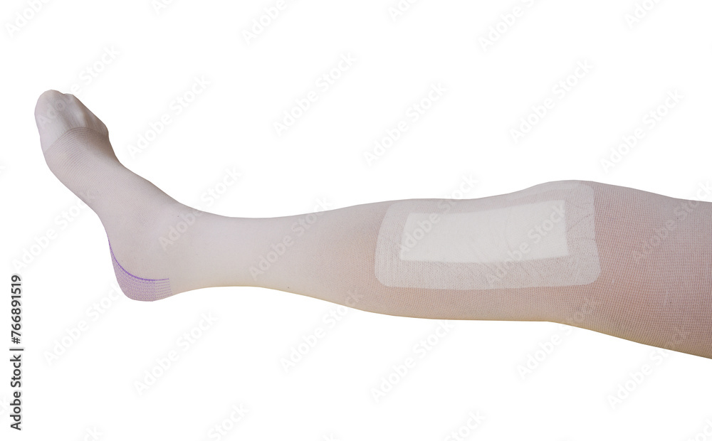 Human leg with bandaid and anti-embolic compression stocking ...