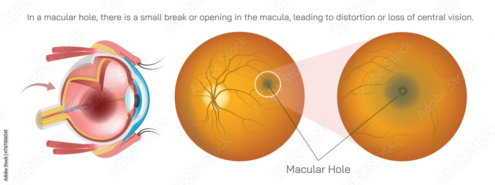 macula is responsible for sharp vision to do activities like reading ...