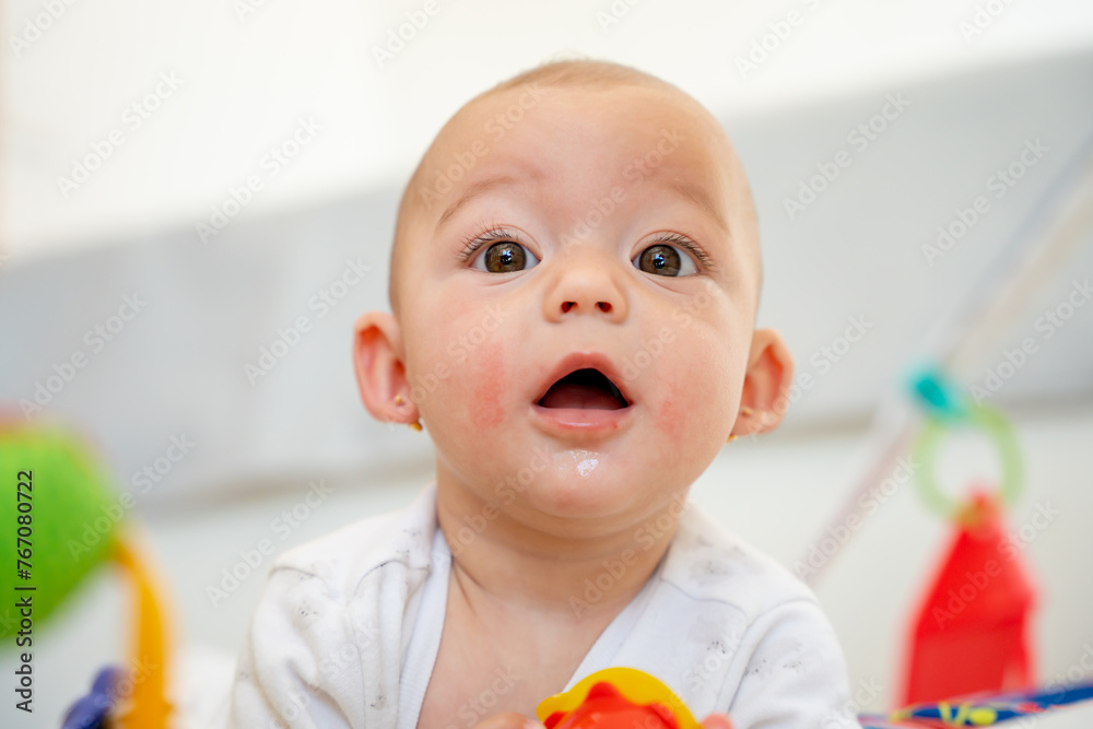 Close-up portrait of a baby with atopic dermatitis on the skin, redness ...