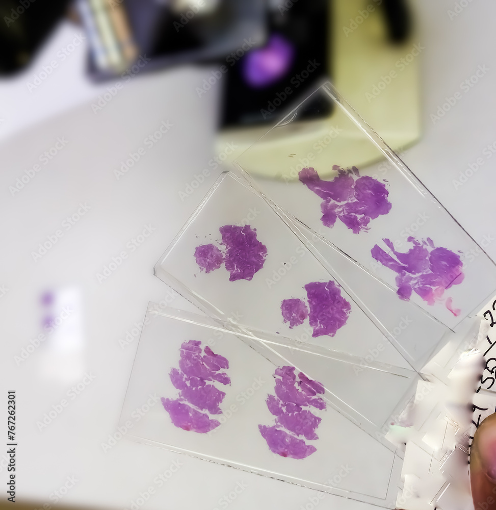 Close view of Histopathology slides stained with hematoxylin and eosin ...