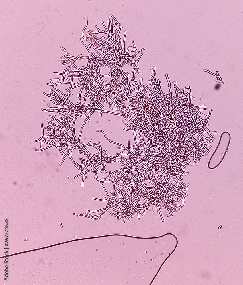 Microscopic image from fungus colonies at Sabouraud Dextrose Agar (SDA ...