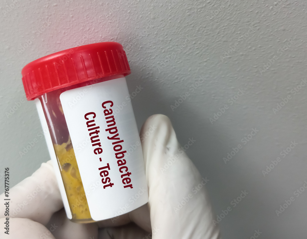 Fecal sample for Campylobacter sp culture test to diagnosis ...