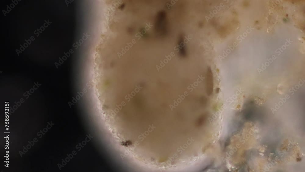 Amoebae move and feed by using pseudopods, which are bulges of ...