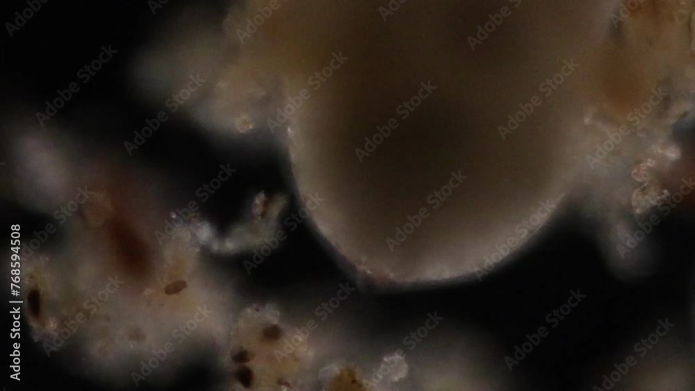 Amoebae move and feed by using pseudopods, which are bulges of ...