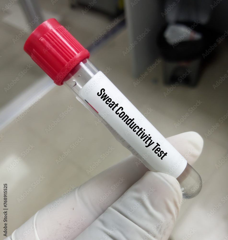 Scientist hold test tube with sample for sweat conductivity test ...