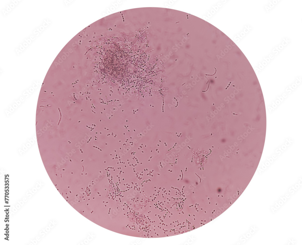 Microscopic image from fungus colonies at Sabouraud Dextrose Agar (SDA ...